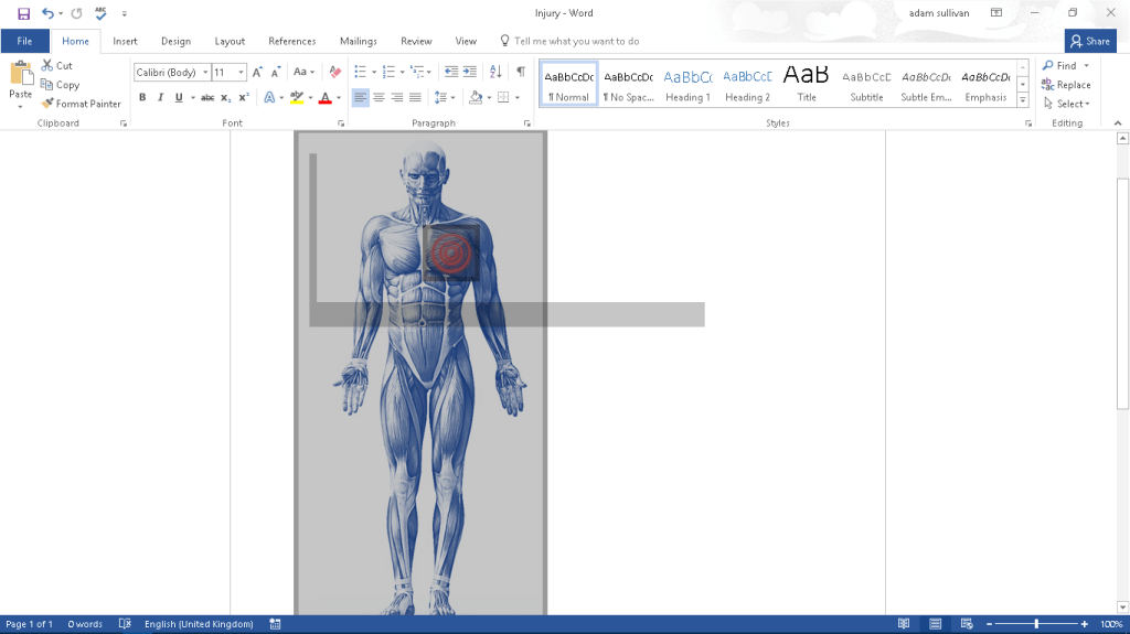 HIGHLIGHT INJURIES ON HUMAN BODY – Dr. Adam Sullivan