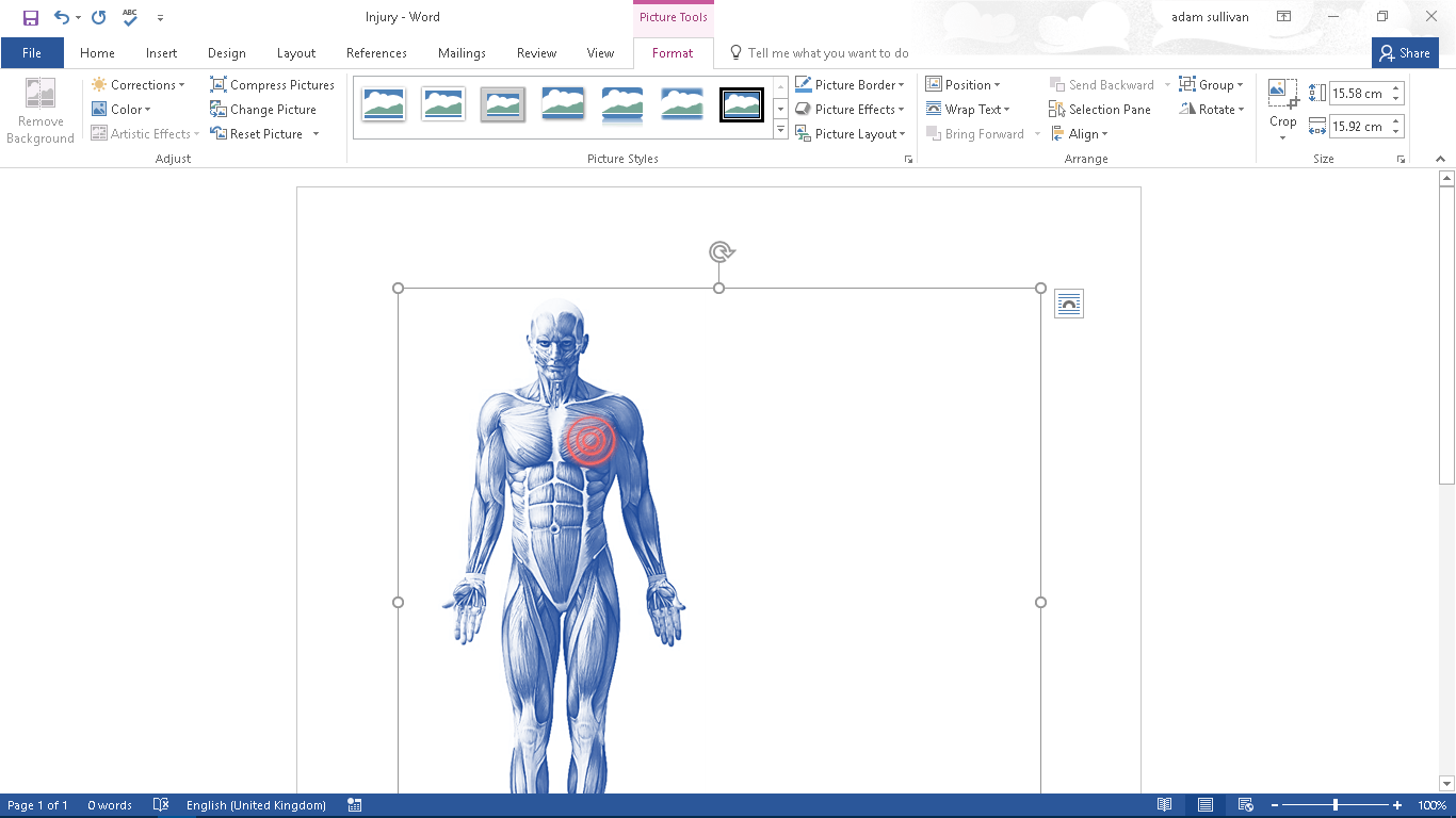 HIGHLIGHT INJURIES ON HUMAN BODY – Dr. Adam Sullivan